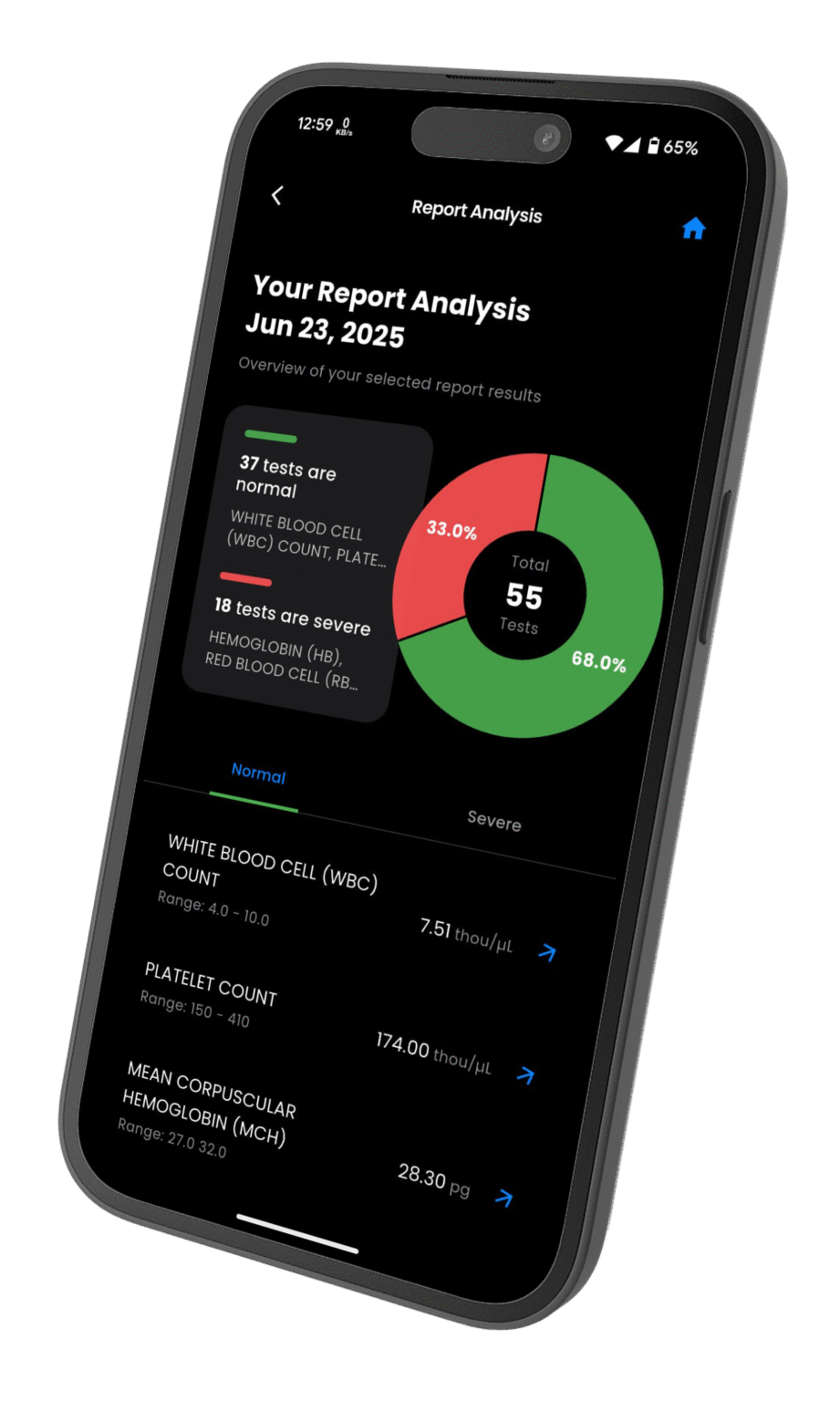 Report Tracker